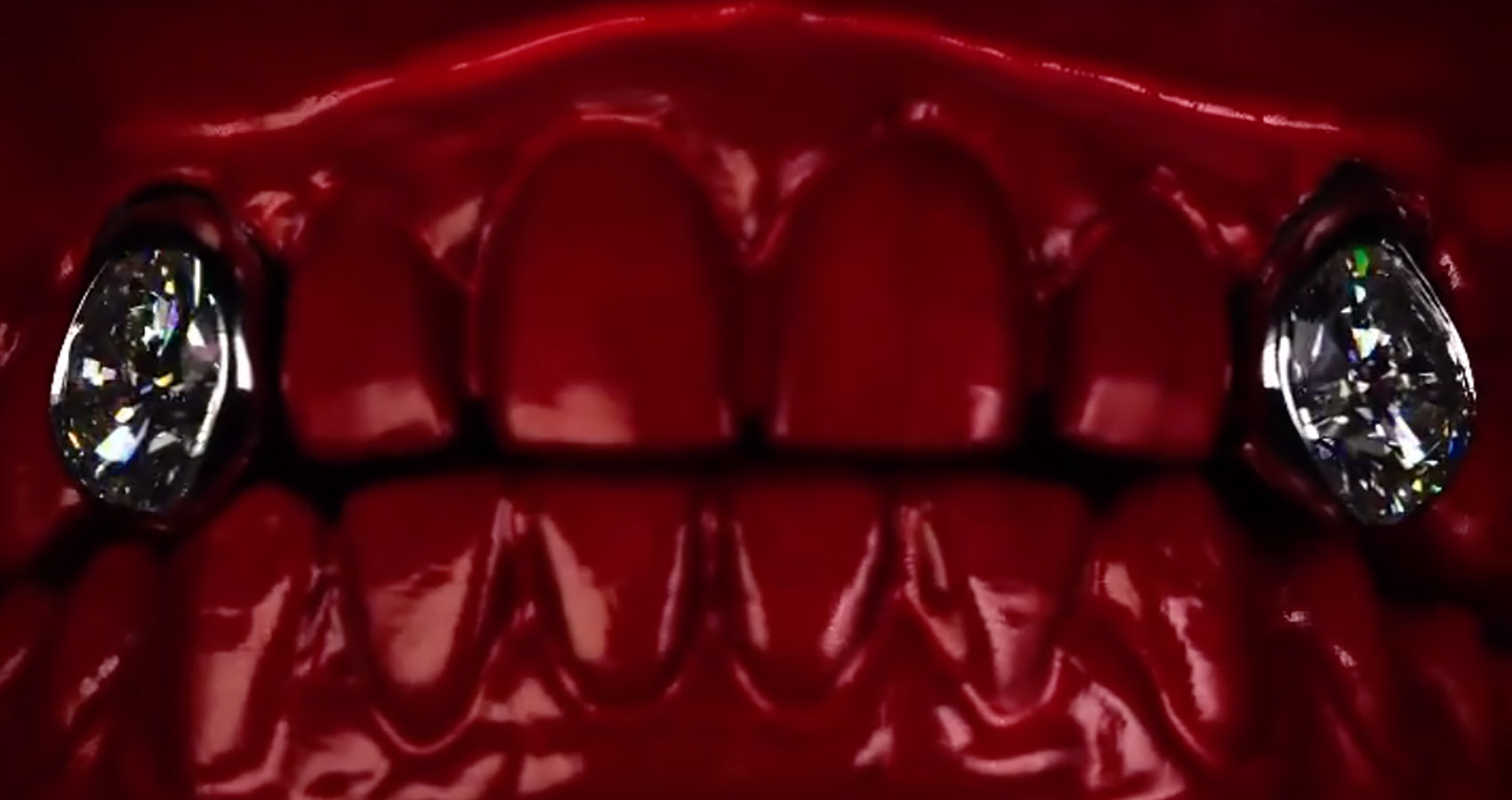 Post Malone Gets New Iced Out Smile Post Malone Gets New Iced Out Smile