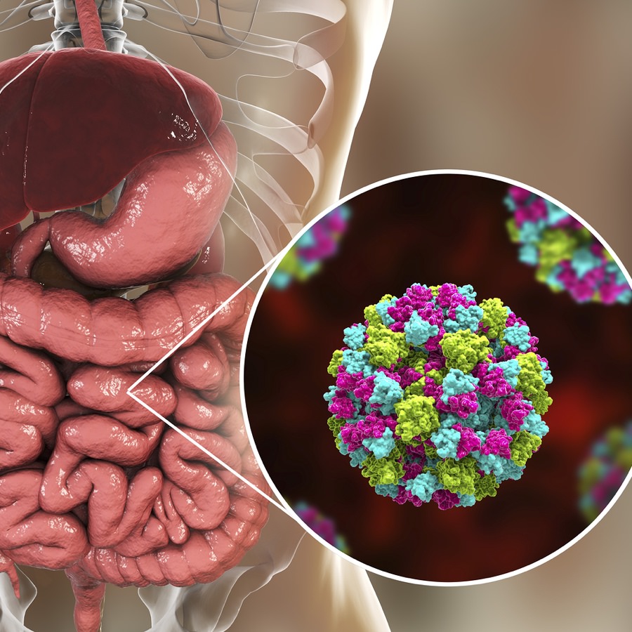 How Can You Avoid Norovirus 2024 The People s Pharmacy